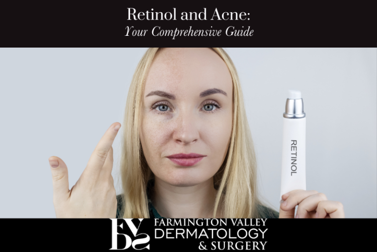 Retinol and Acne: Your Comprehensive Guide | Farmington Valley ...