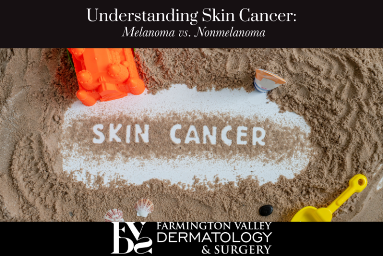 Understanding Skin Cancer: Melanoma vs. Nonmelanoma | Farmington Valley ...